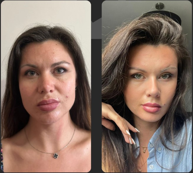 Top Board Certified Plastic Surgeons in Istanbul: What You Need to Know ...